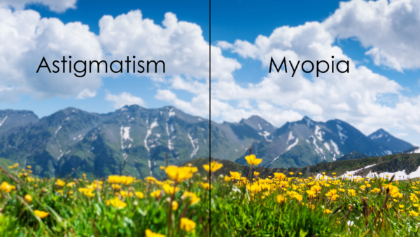 What’s the Difference Between Myopia and Astigmatism? | Invision Optometry